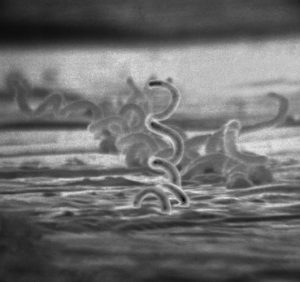 STDs gonorrhoea and syphilis hit record levels in Europe - Church of ...
